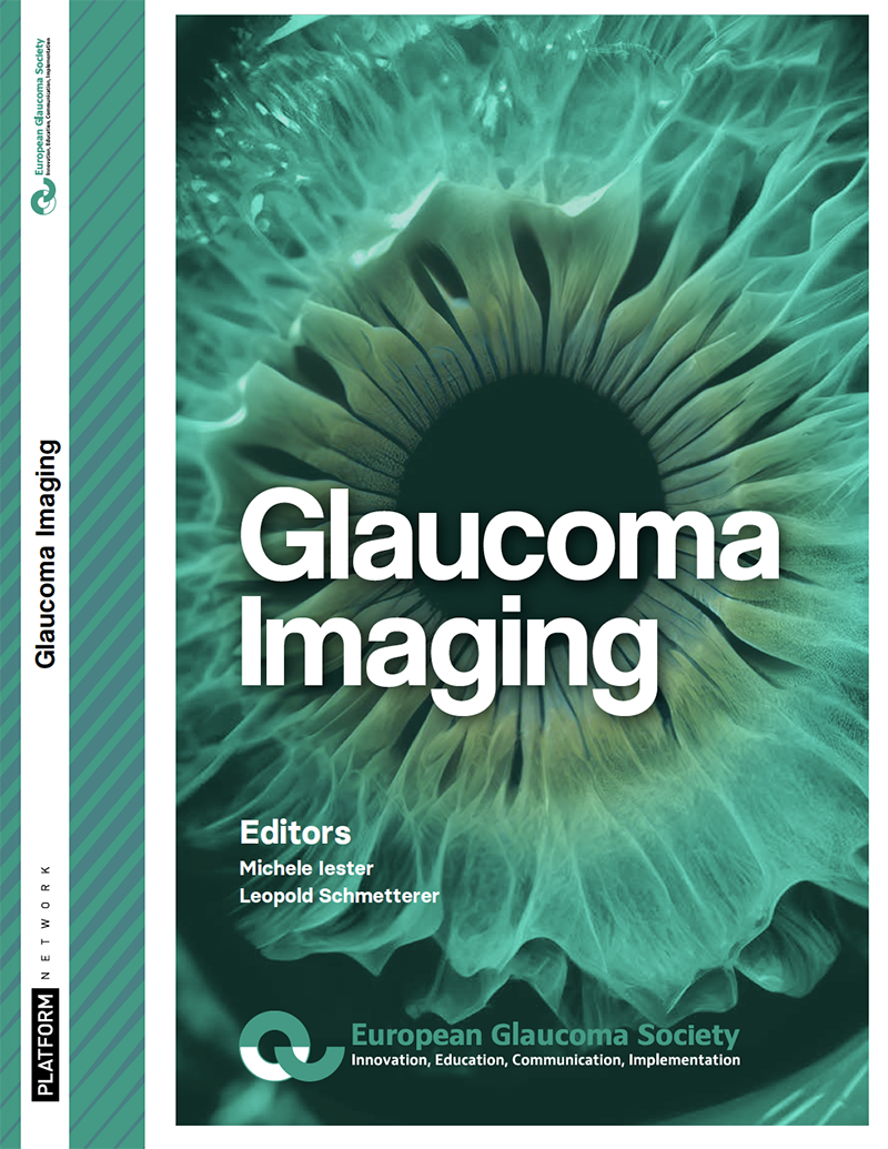European Glaucoma Society