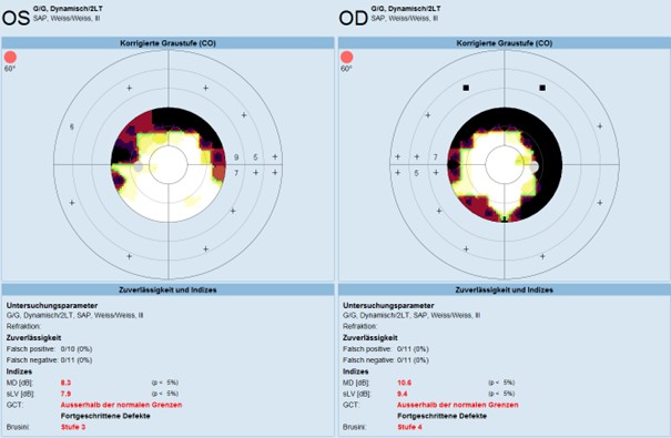 European Glaucoma Society